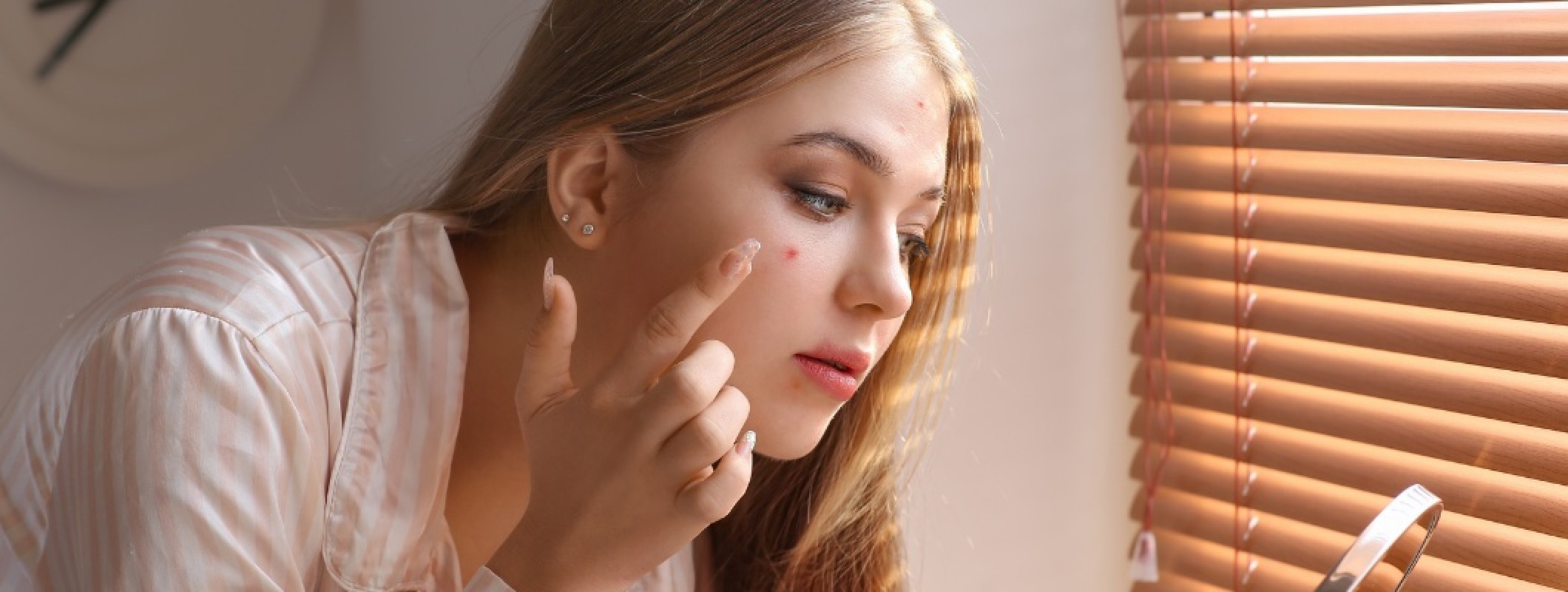 ᐉ Fighting Acne: How to Achieve Clean and Healthy Skin - Benepura.com