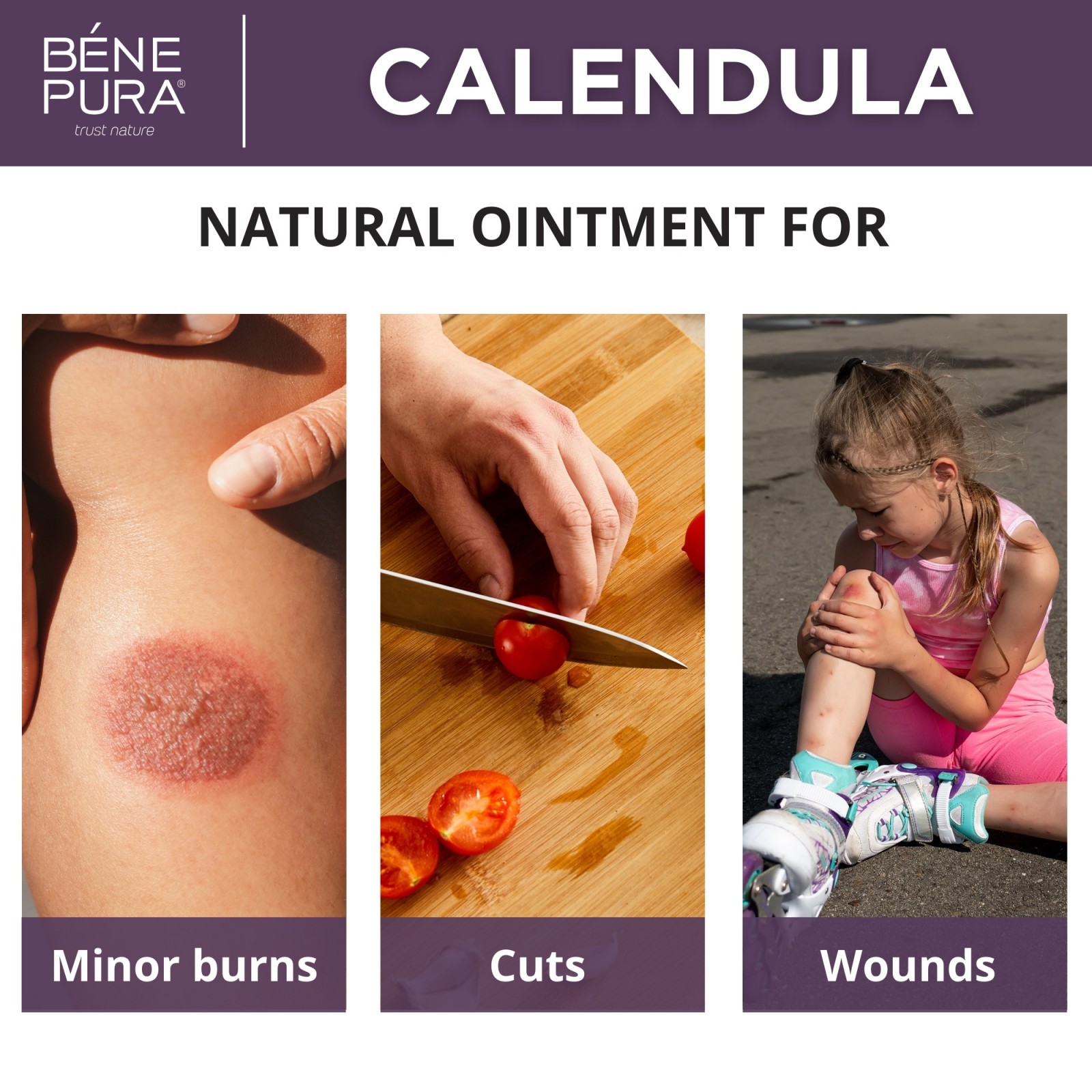 ᐉ Ointment for Wounds, Burns and Scars with Calendula - 40ml - Benepura.com