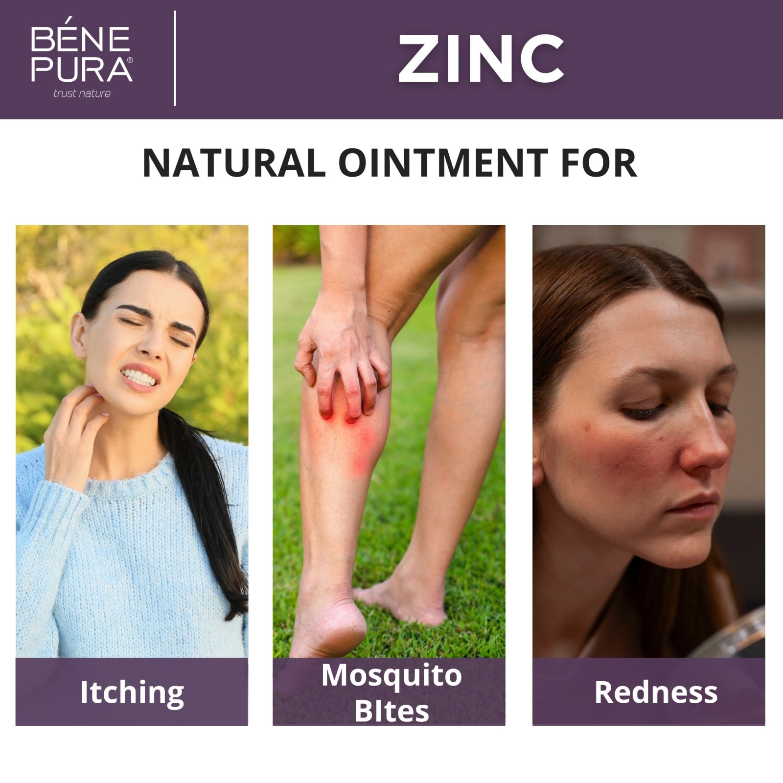 ᐉ Zinc ointment for Itching and Rashes - 40ml - Benepura.com